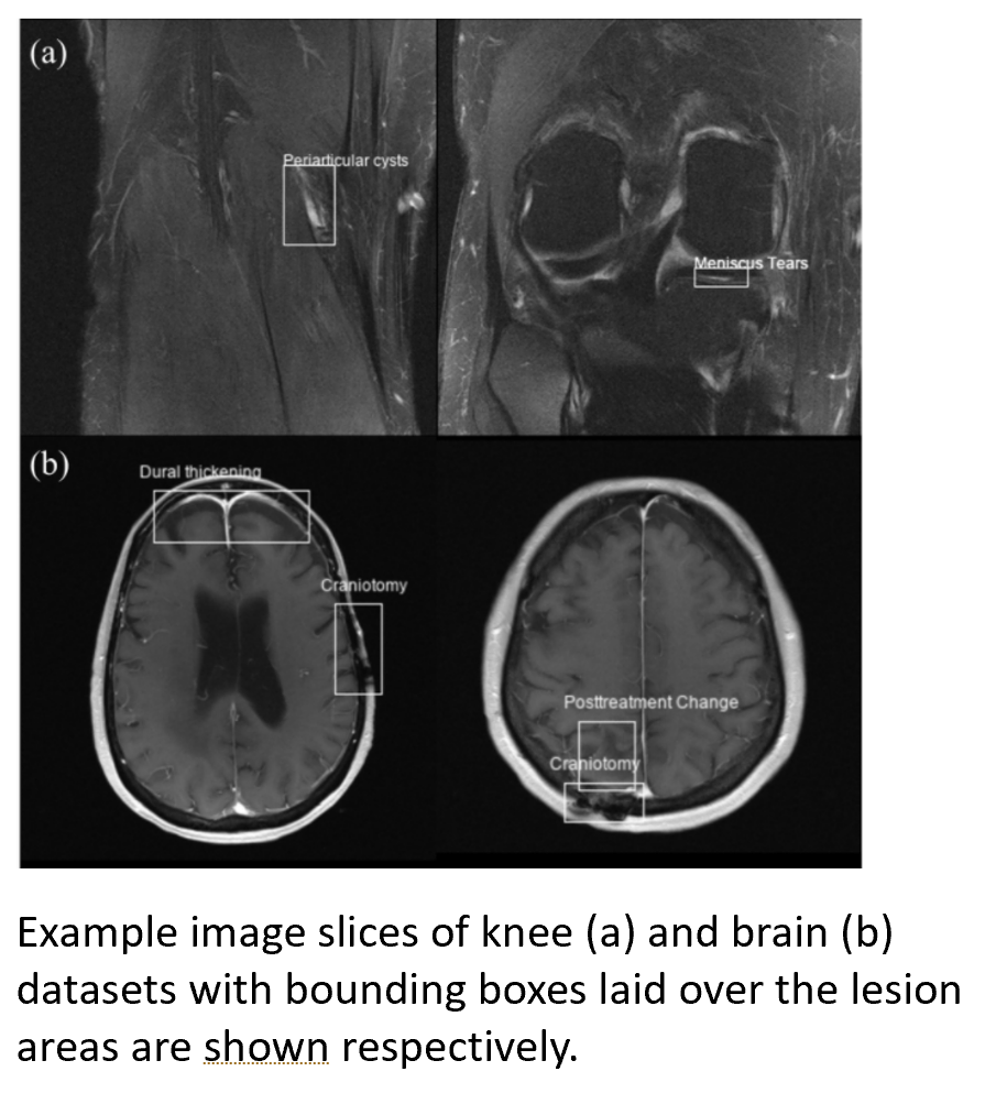 fastMRI+: Clinical Pathology Annotations for Knee and Brain Fully ...