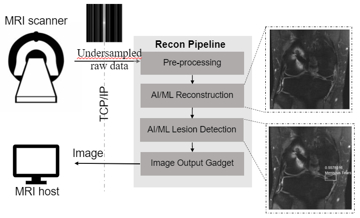 Machine Learning for Image Reconstruction - Microsoft Research