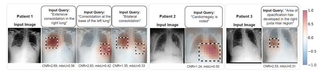 Making the Most of Text Semantics to Improve Biomedical Vision-Language ...