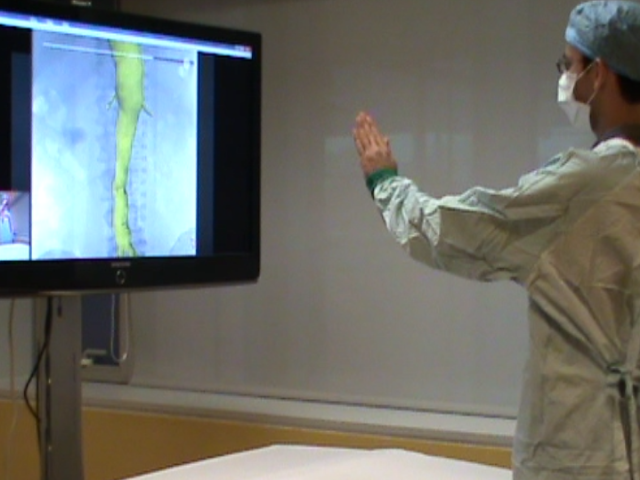Touchless Interaction in Surgery - Microsoft Research